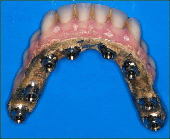 Attachment Considerations, Options and Selection Part I – What's in ...