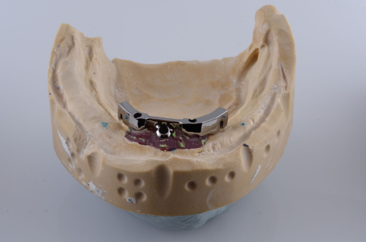 Attachment Considerations, Options and Selection Part II – What's in ...