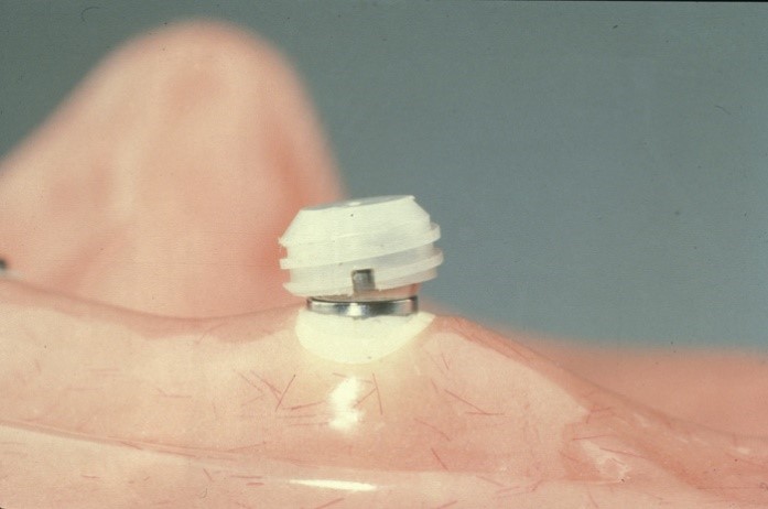 Attachment Considerations, Options and Selection Part II – What's in ...