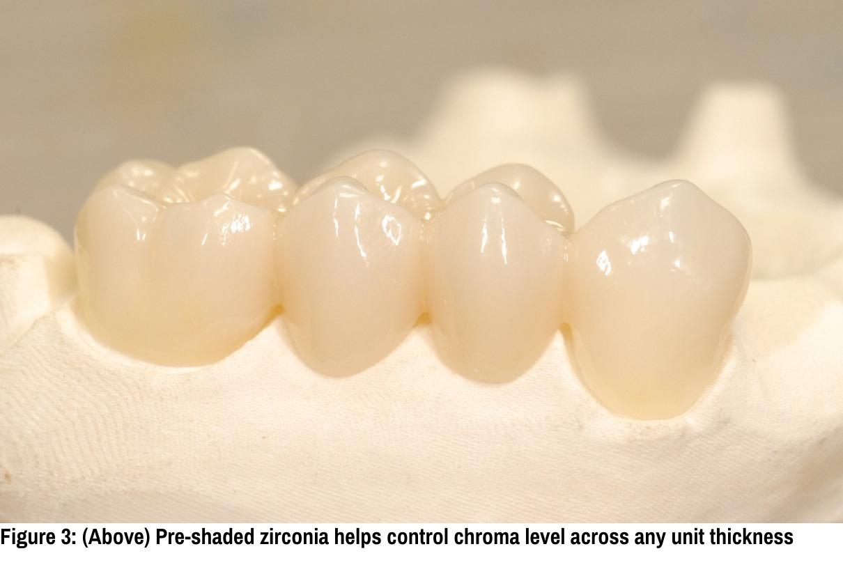Zirconia Options: The Deciding Factors – The Production – What's in ...
