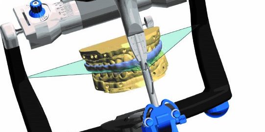 Digital Impressions – What's in Your Mouth?