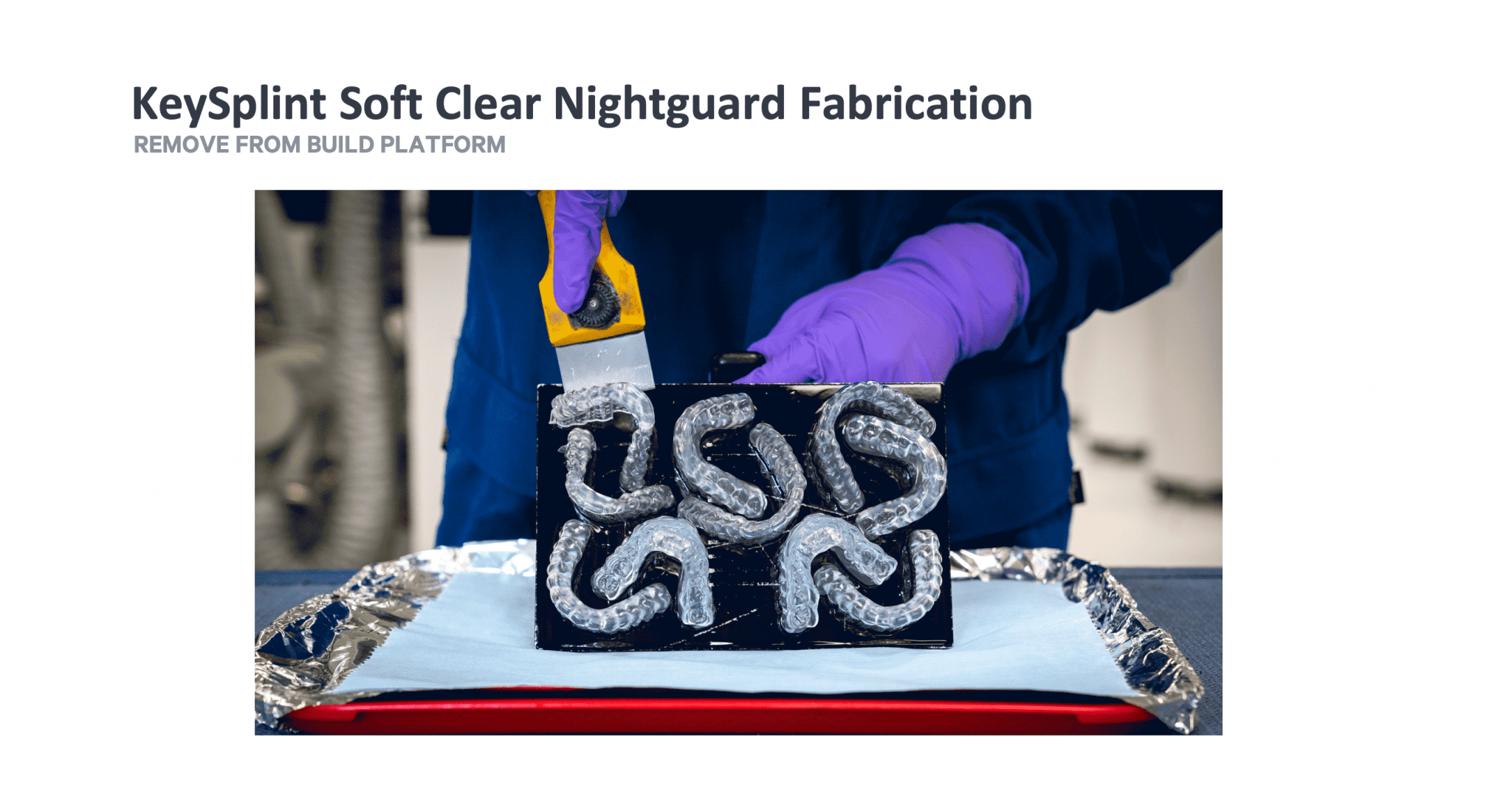 3D Printed Night Guards with KeySplint Soft Resin; The Game Changer for ...