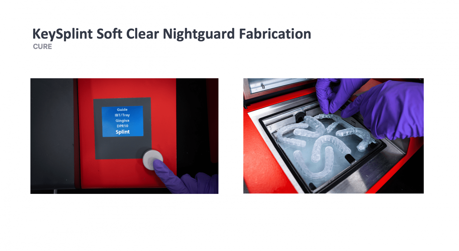 3D Printed Night Guards with KeySplint Soft Resin; The Game Changer for ...