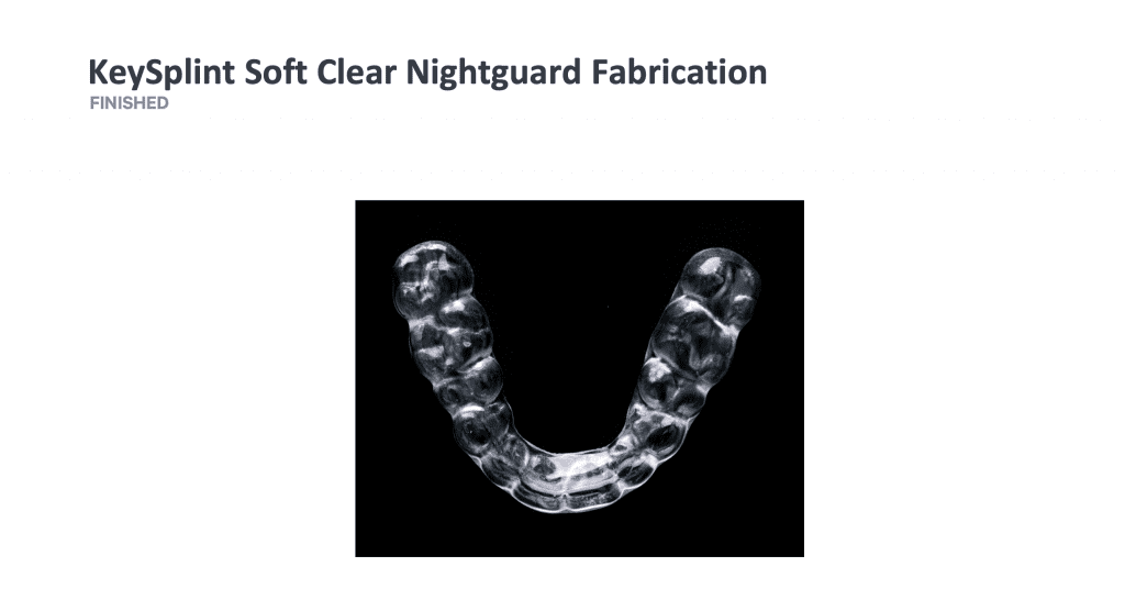 3D Printed Night Guards with KeySplint Soft Resin; The Game Changer for ...