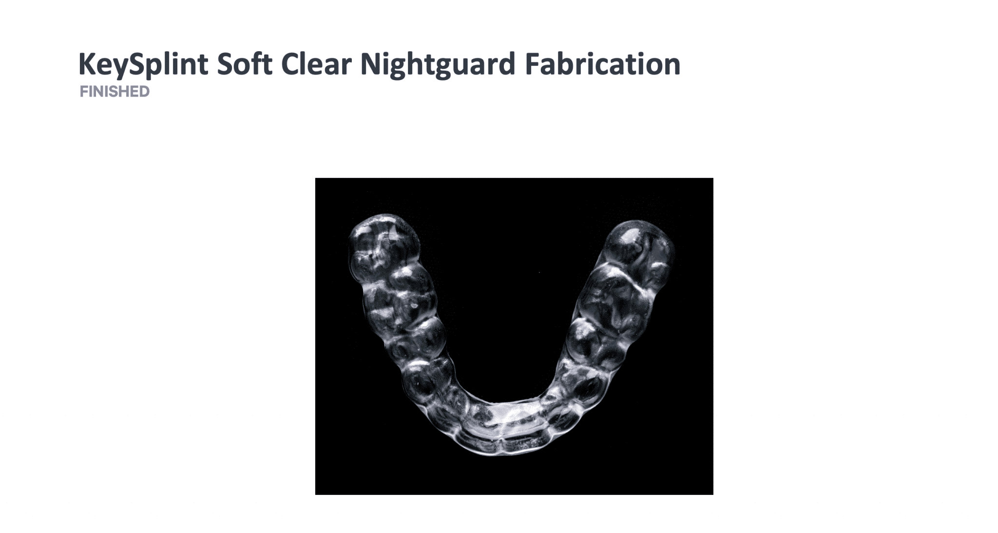 3D Printed Night Guards with KeySplint Soft Resin; The Game Changer for ...