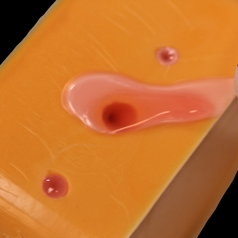 The Wax Duplicate Denture Technique: A Guide for Replication Accuracy ...