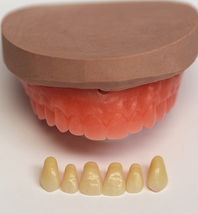 The Wax Duplicate Denture Technique: A Guide for Replication Accuracy ...