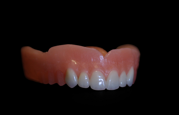 The Wax Duplicate Denture Technique: A Guide for Replication Accuracy ...