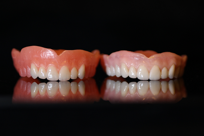 The Wax Duplicate Denture Technique: A Guide for Replication Accuracy ...