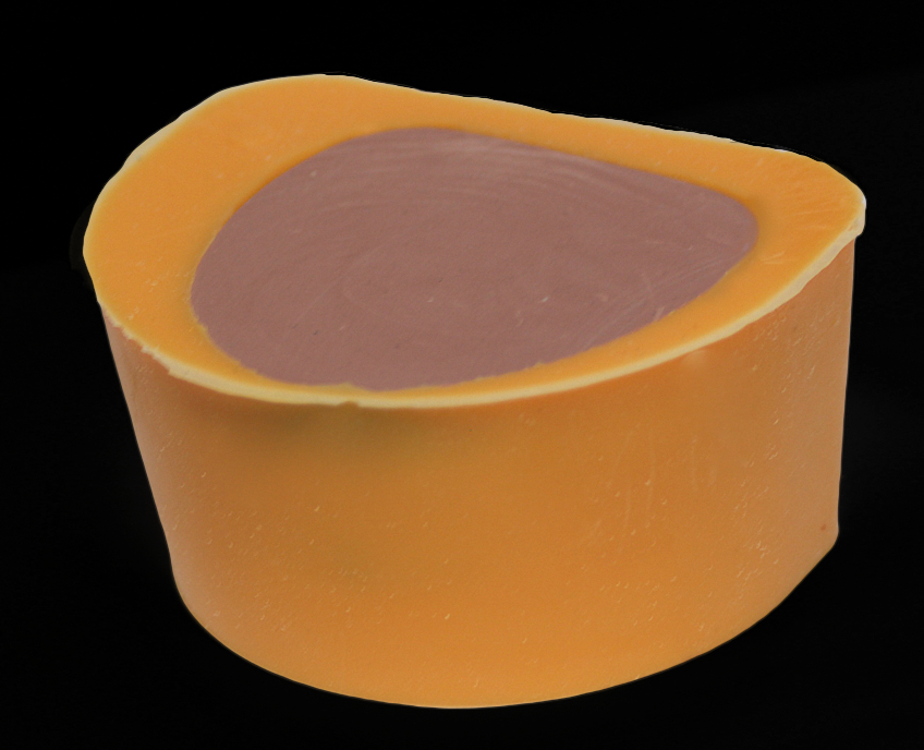 The Wax Duplicate Denture Technique: A Guide for Replication Accuracy ...