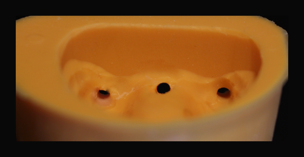 The Wax Duplicate Denture Technique: A Guide for Replication Accuracy ...