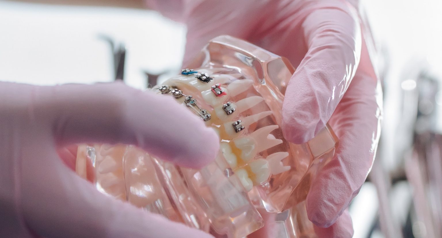 Making Braces Fun for Your Kids – What's in Your Mouth?